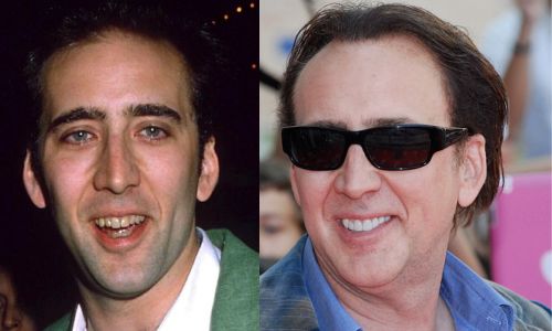 Nicolas Cage Young Teeth